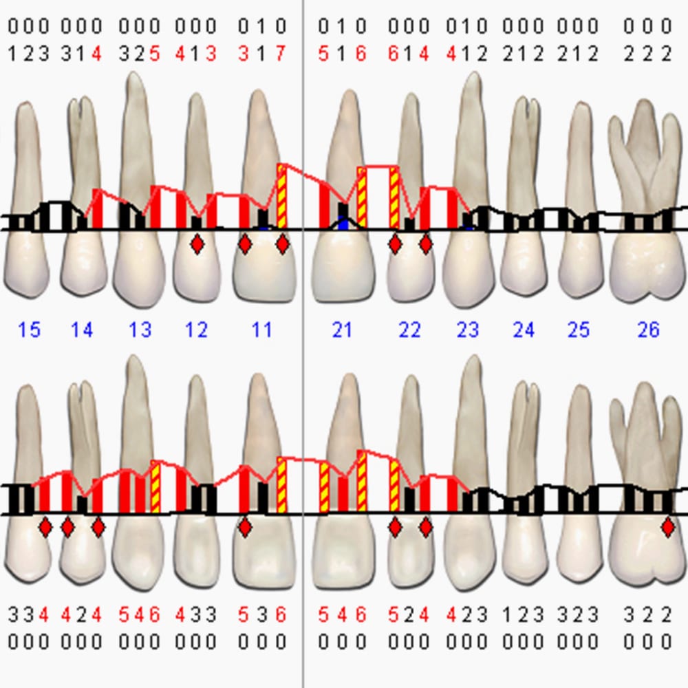 Zahnfleisch & Parodontitis - Praxisfamilie Köhrer & Kollegen